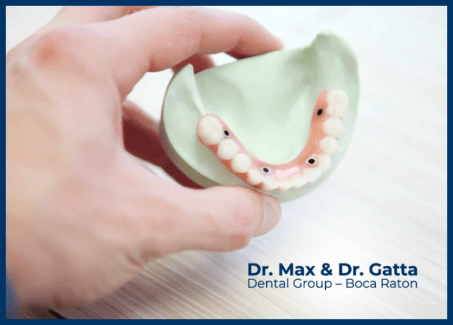 Guide to Dental Implants: A Popular Option for Tooth Replacement